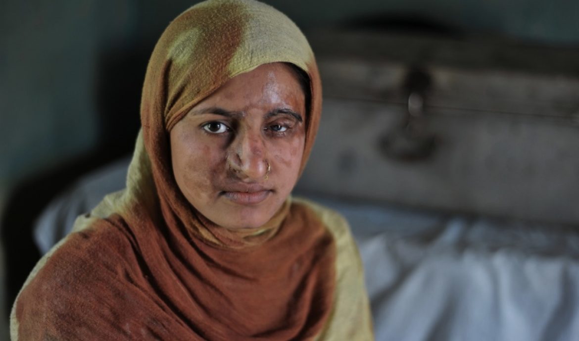 Facing the Facts of Acid Attacks - Aquila Style